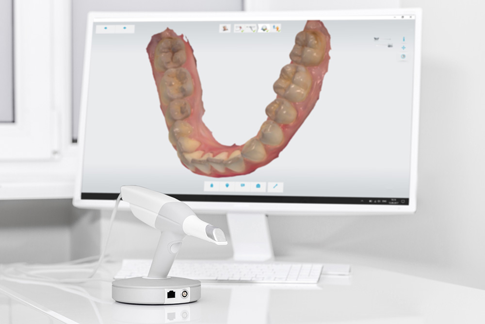 We Have Digital Impression Technology in Bucyrus | Oakwood Dental